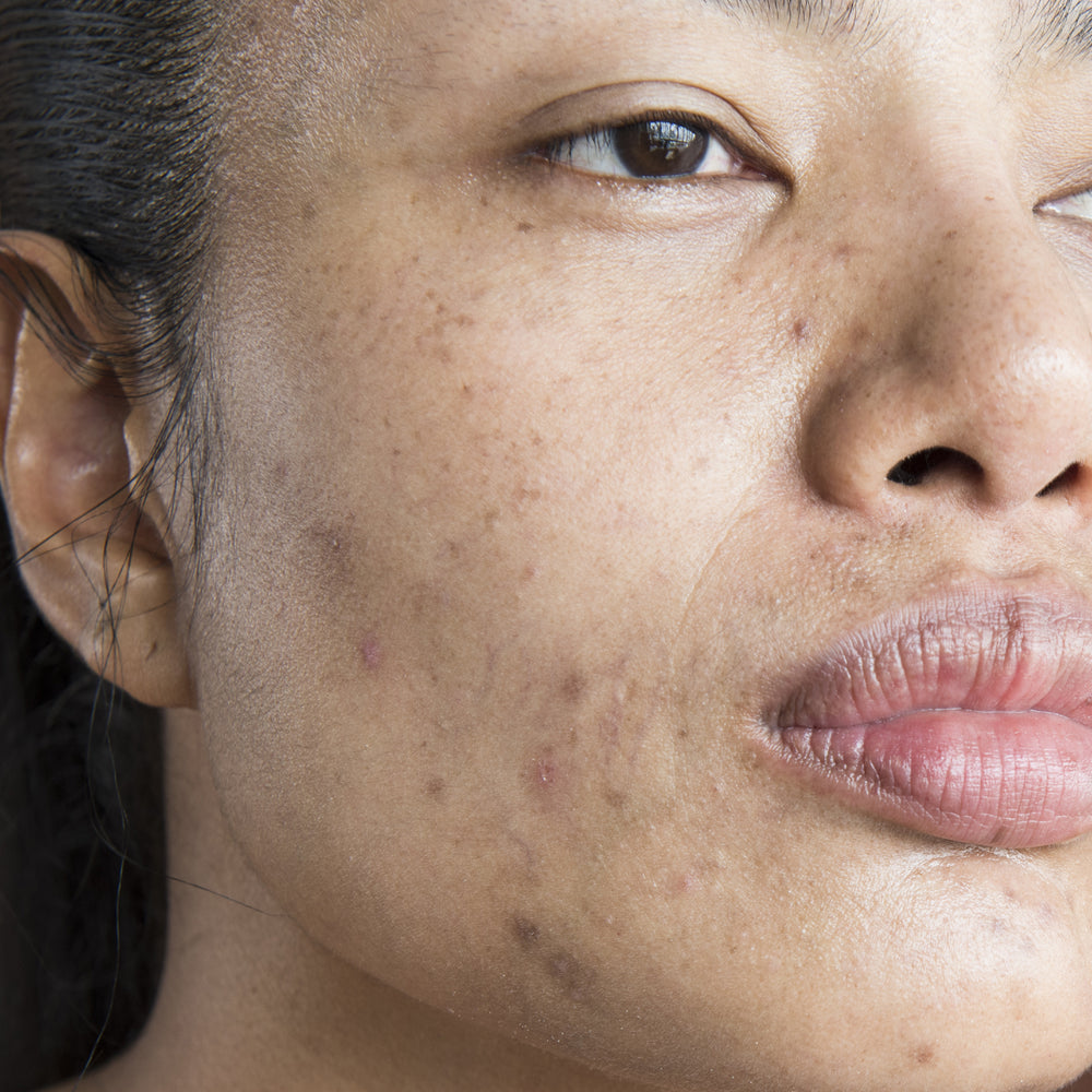 Silki™ - Affordable Quality Skincare