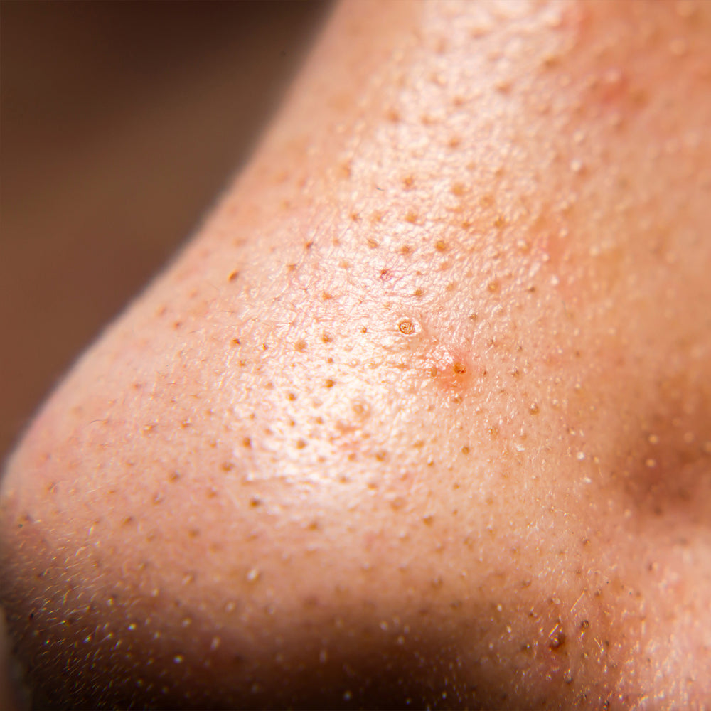 Silki™ - Affordable Quality Skincare